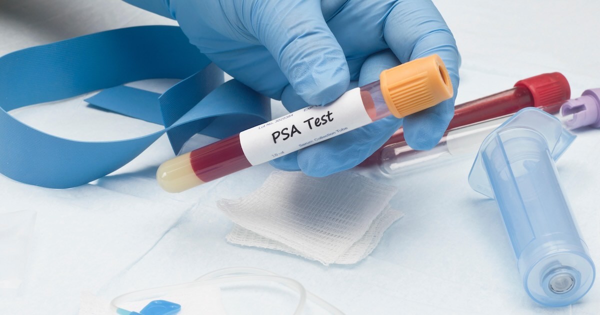 Guardian corrects article about GPs refusing to give prostate cancer ...