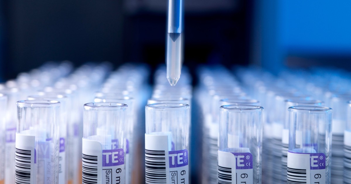 Spiking: Very rare to contract HIV through used needle – Full Fact