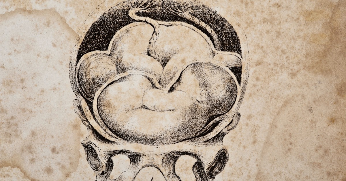 What do we know about the Covid-19 vaccines crossing the placenta ...